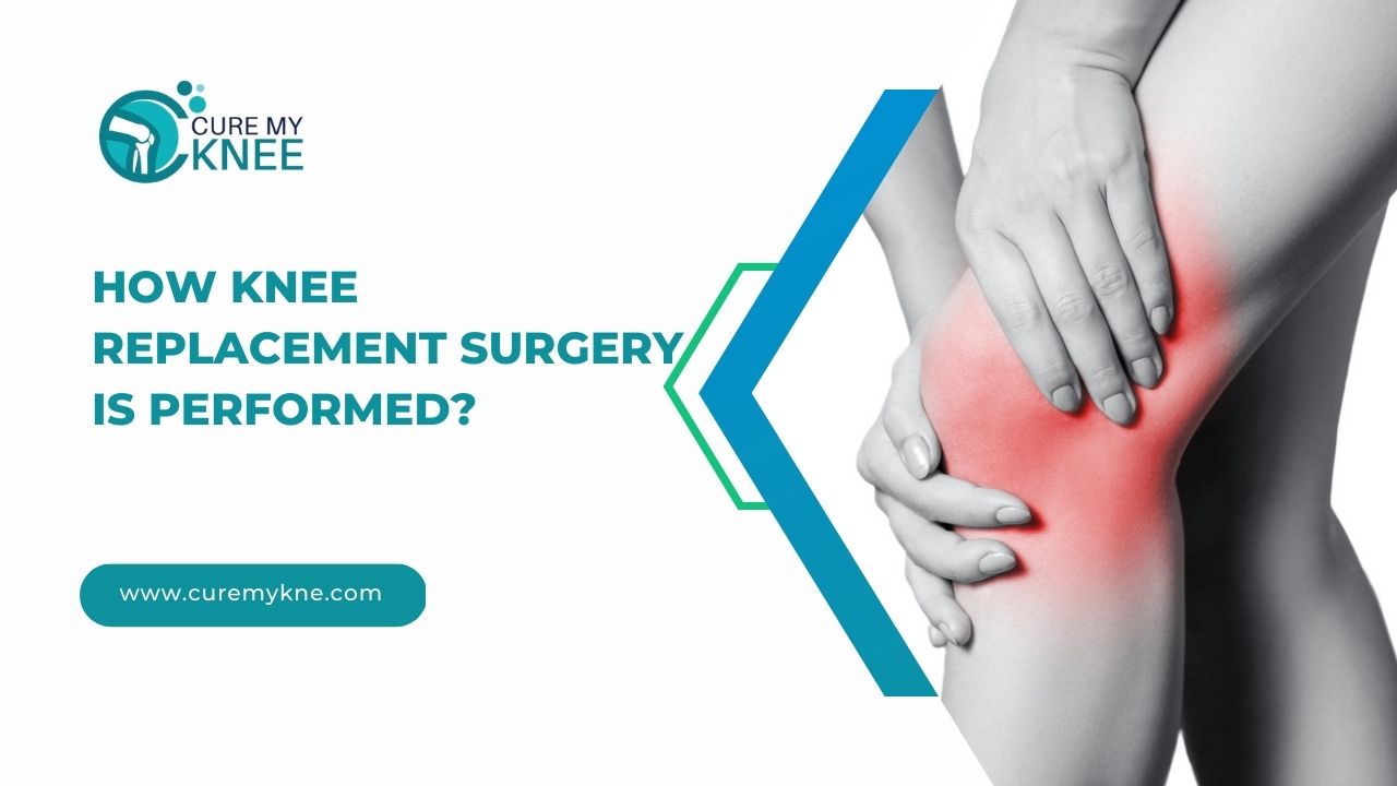 Step-by-Step Knee Replacement Surgery Guide - MindxMaster